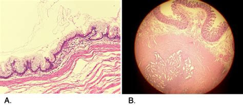 Left Figure 3a Microscopic View Of A Cross Section Of The Appendix