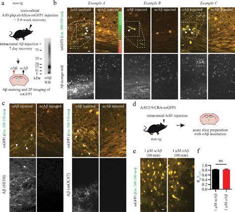 Intracranial Injection Of Oligomeric Aβ Oaβ Drives Ox Stress Download Scientific Diagram