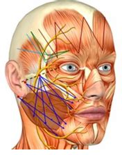 Neurological Complications Of Thread Lifting Auctores