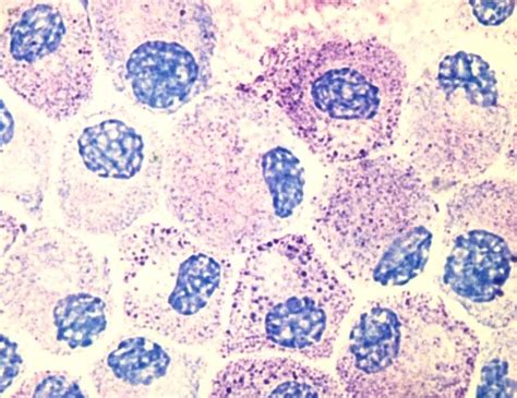 Histamine Mast Cells And Hay Fever Allergies Healdove