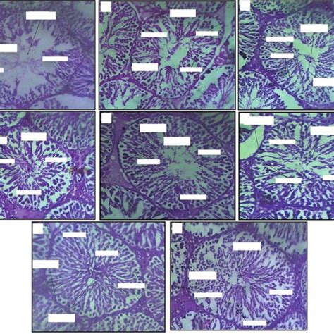 Histology Of The Testis At Different Doses And Groups A H