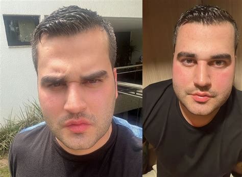 jovem victor bezerra voltou com o coraÇÃo nas mÃos de carnÁ recifense