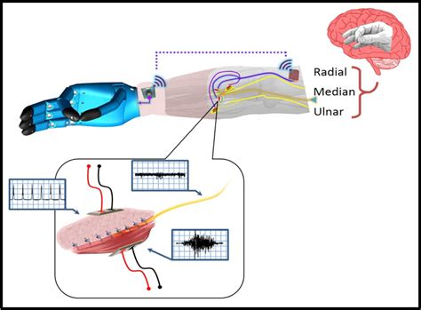 Fabrication Of The Composite Regenerative Peripheral Nerve Interface C Rpni In The Adult Rat
