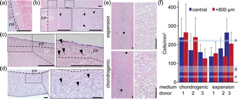 Prevention Of Cell Invasion By Perichondrium Can Be Overcome By Download Scientific Diagram