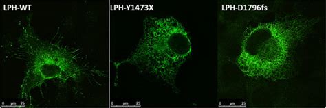Intracellular Localization Of Wild Type And The Mutants In Cos 1 Cells