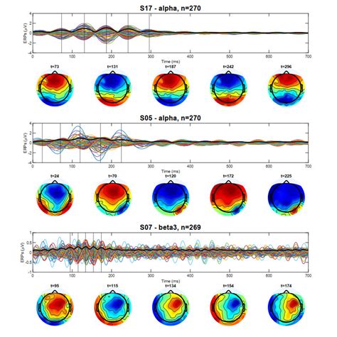 Characterization Of Spatiotemporal Dynamics In Eeg Data During Picture