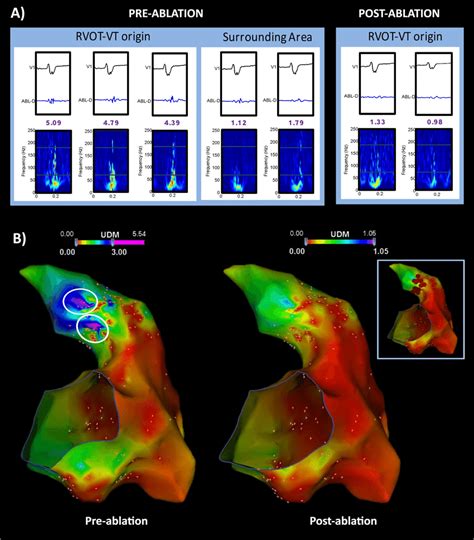 The Hilbert Huang Transformation Hht Spectra And Safe T Maps Before Download Scientific