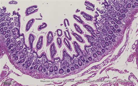 Low Magnification Micrograph Of The Jejunal Mucosa Showing The Tall Villi Lined By Simple