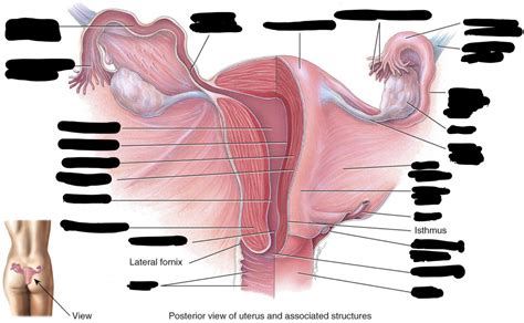 Posterior Uterus Diagram Quizlet
