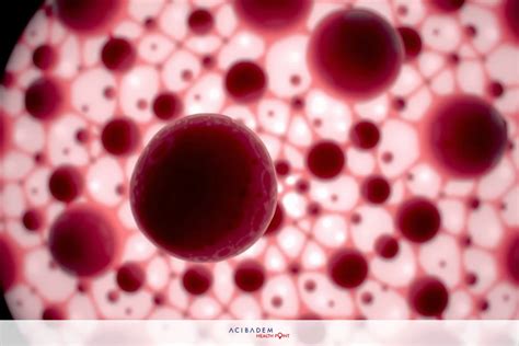 The Ct Scan For Giant Cell Arteritis Detection Acibadem Health Point