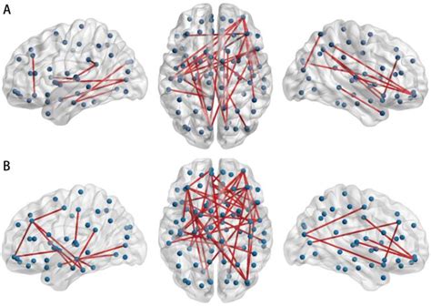 Cognition Mediates The Relation Between Structural Network Efficiency And Gait In Small Vessel