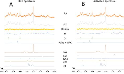 typical spectral deconvolution of mrs spectra a deconvolution of a