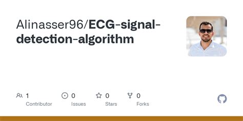 Github Alinasser Ecg Signal Detection Algorithm
