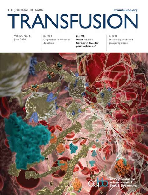 A Lower Fibrinogen Threshold Does Not Lead To Increased Bleeding Risk
