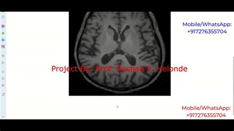 Types Of Brain Tumor Detection Using Image Processing Python Project