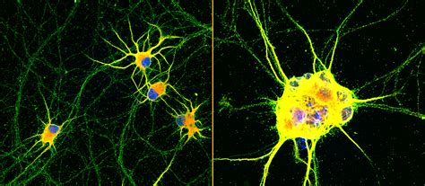Mature ‘Lab Grown’ Neurons Hold Promise for Neurodegenerative Disease | News | Northwestern ...
