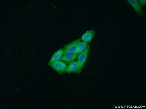 Mcp1 Antibody 25542 1 Ap