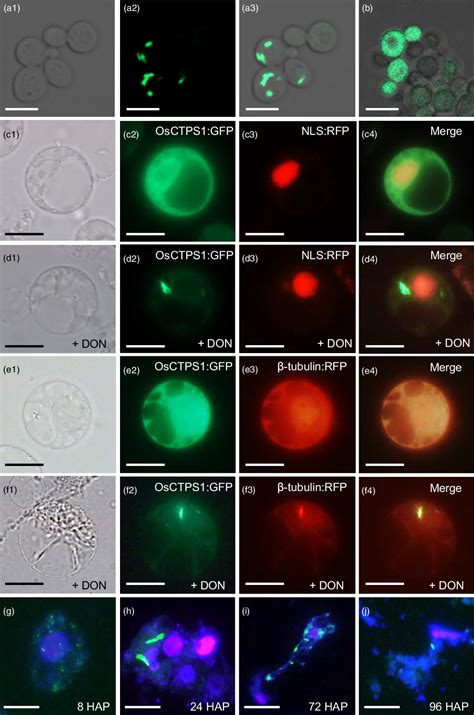 Figure 7 From Ctp Synthase Is Essential For Early Endosperm Development By Regulating Nuclei