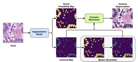 Syed Nauyan Rashid On Linkedin Ai Histopathology Deeplearning