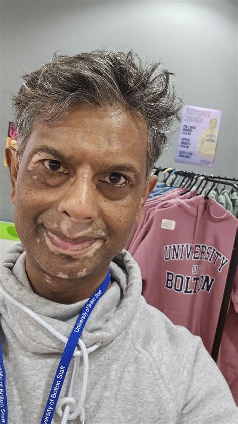 Globalyouthwork Dr Rajesh Patel