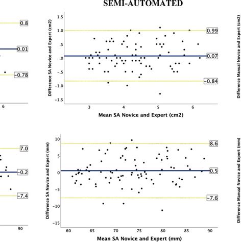 Tee Novice Vs Tee Expert The Blandaltman Plots For Aortic Annular Download Scientific Diagram