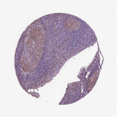 Tissue Expression Of Cd14 Staining In Tonsil The Human Protein Atlas
