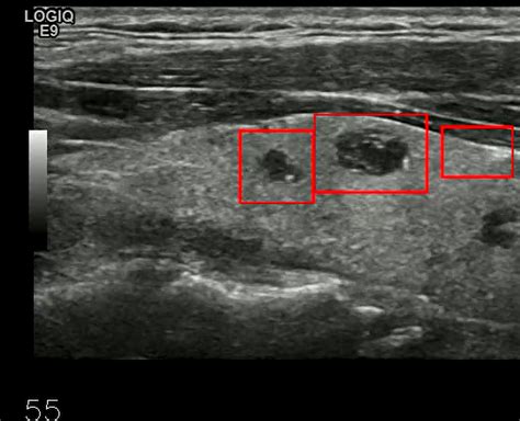 【开发技术】net使用ffmpeg视频特定帧上绘制内容