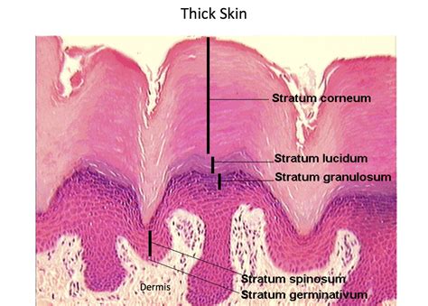 Thick Skin Epidermal Layers Histology Thick Skin Alpha Hydroxy
