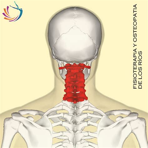 Lesiones Cervicales Y Su Tratamiento Con Osteopatía Fisioterapia De