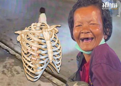 อ่านผลชันสูตรป้ากบ เพจดังชี้ตาย 3 รอบได้เลย อธิบายชัด ภาวะอกรวน ทรมานแค่ไหน Matichon Online