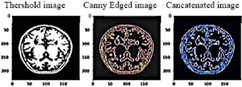 Canny Edge And Threshold Segmentation Download Scientific Diagram