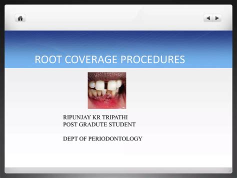 ROOT COVERAGE PROCEDURES PPTX