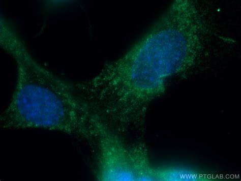 Osteocalcin Fusion Protein Ag Proteintech