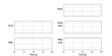 Respiratory Rate Estimation By Peterhcharlton