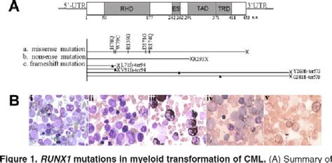 Figure 1 From Blown Leukemia Chronic Myeloid Leukemia And Their Contribution To Inducing Murine