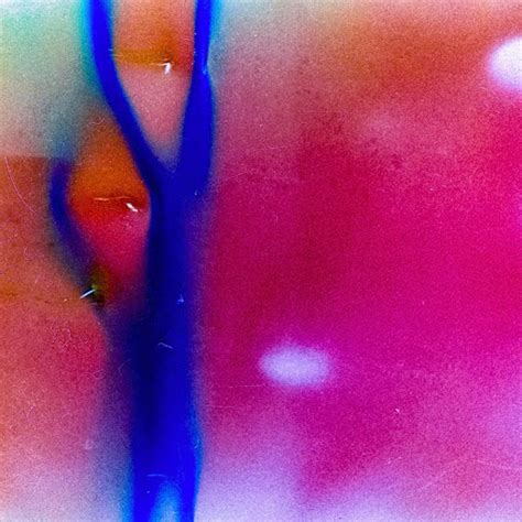 Treeline YouTube Music