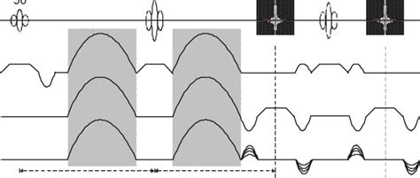 8 Fast Spin Echo Sequence With Unipolar Diffusion Weighting The Download Scientific Diagram
