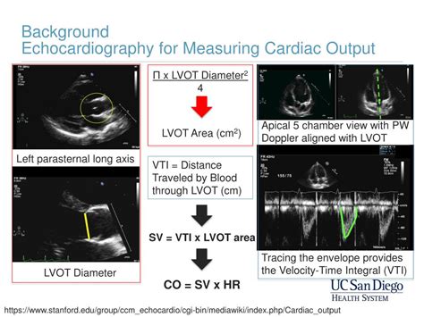 PPT Electrical Cardiometry For The Measurement Of Cardiac Output In Pregnancy PowerPoint
