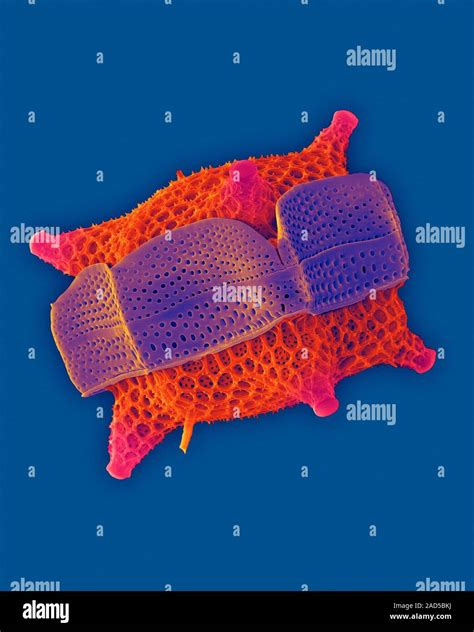 Coloured Scanning Electron Micrograph Sem Of Marine Centric Diatom