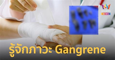 Gangrene รวมข่าวของ Gangrene อัพเดตเรื่อง Gangrene