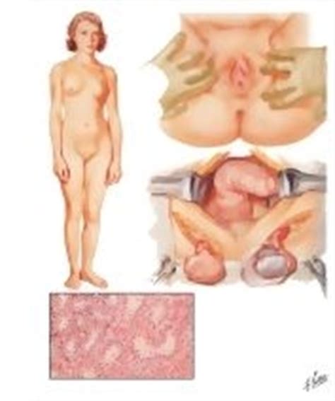 Disorders Of Sex Development