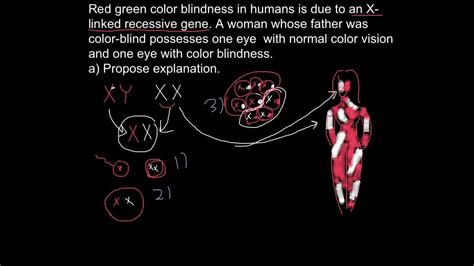 X Chromosome Mosaicism In Women Youtube