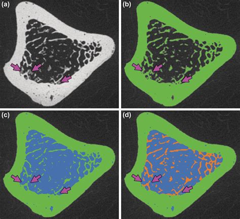 Benefits Of Segmentation Based On Deep Learning A Raw Slice View Of