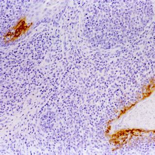 Tonsil Experiment I PID Positive Immunohistochemical Staining Download Scientific Diagram