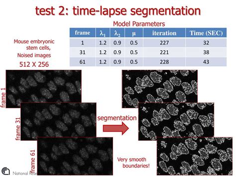 Ppt Mathematical And Computational Issues For Live Cell Segmentation In Fluorescence