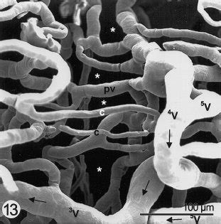 Arrangement And Course Of The Venous Vasa Vasorum V To V Note The Download Scientific