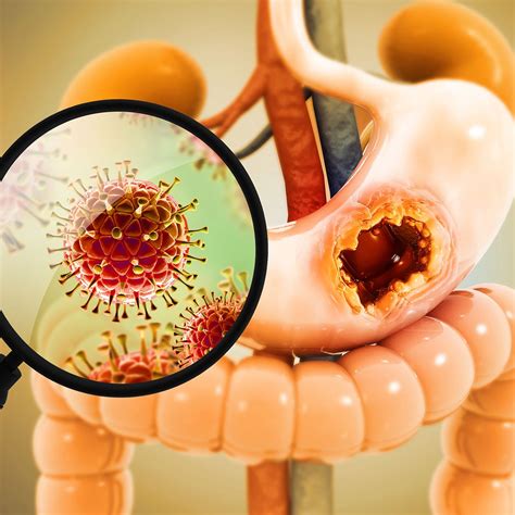 Zanzalintinib Combo Improves Survival In Metastatic Colorectal Cancer