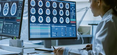 Penn Dbei Detecting Multiple Sclerosis Lesions Via Intermodal