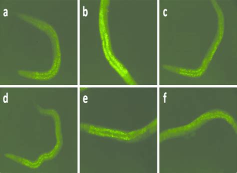 Autofluorescence Of Lipofuscin Granules In The Intestines Of C