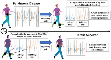 Device Gait Assessment At Jennifer Pardue Blog